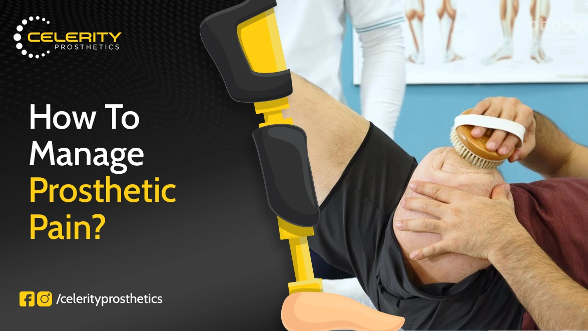 How to Manage Prosthetic Pain? - Celerity Prosthetics