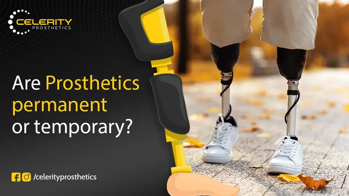 Are Prosthetics Permanent or Temporary?